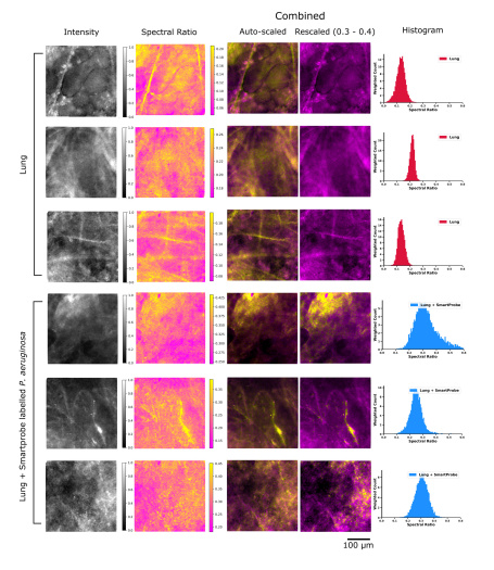 Ratiometric spectral imaging through fibre to make the bacteria shine ...
